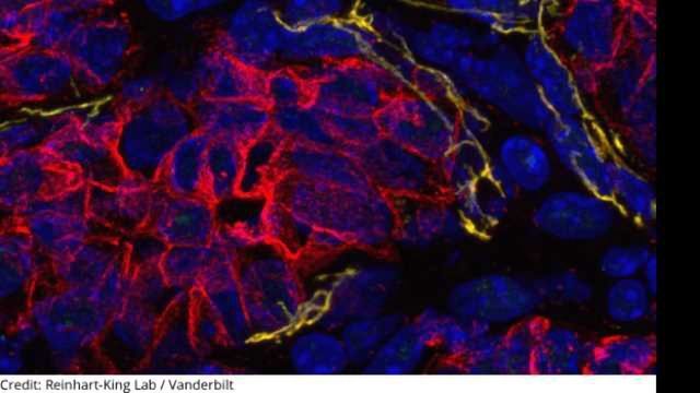 Improving Cancer Treatments by Softening the Extracellular Matrix ...