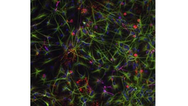 Mouse study offers new clues to cognitive decline | Technology Networks