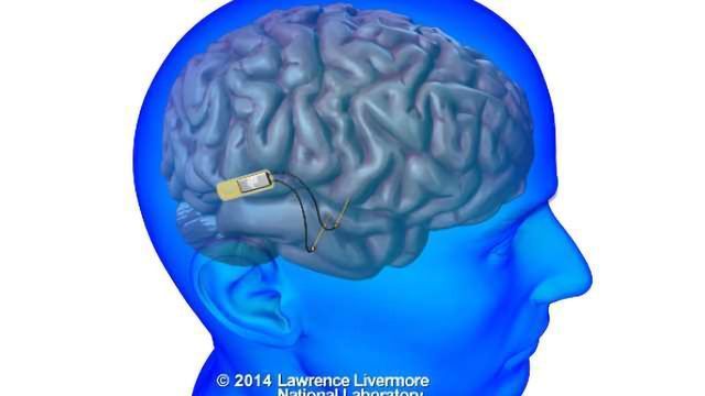 DARPA taps Lawrence Livermore to develop world's first neural device to ...