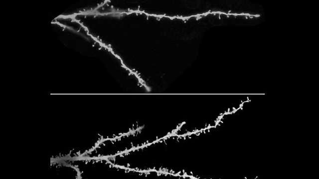 Children with autism have extra synapses in brain | Technology Networks
