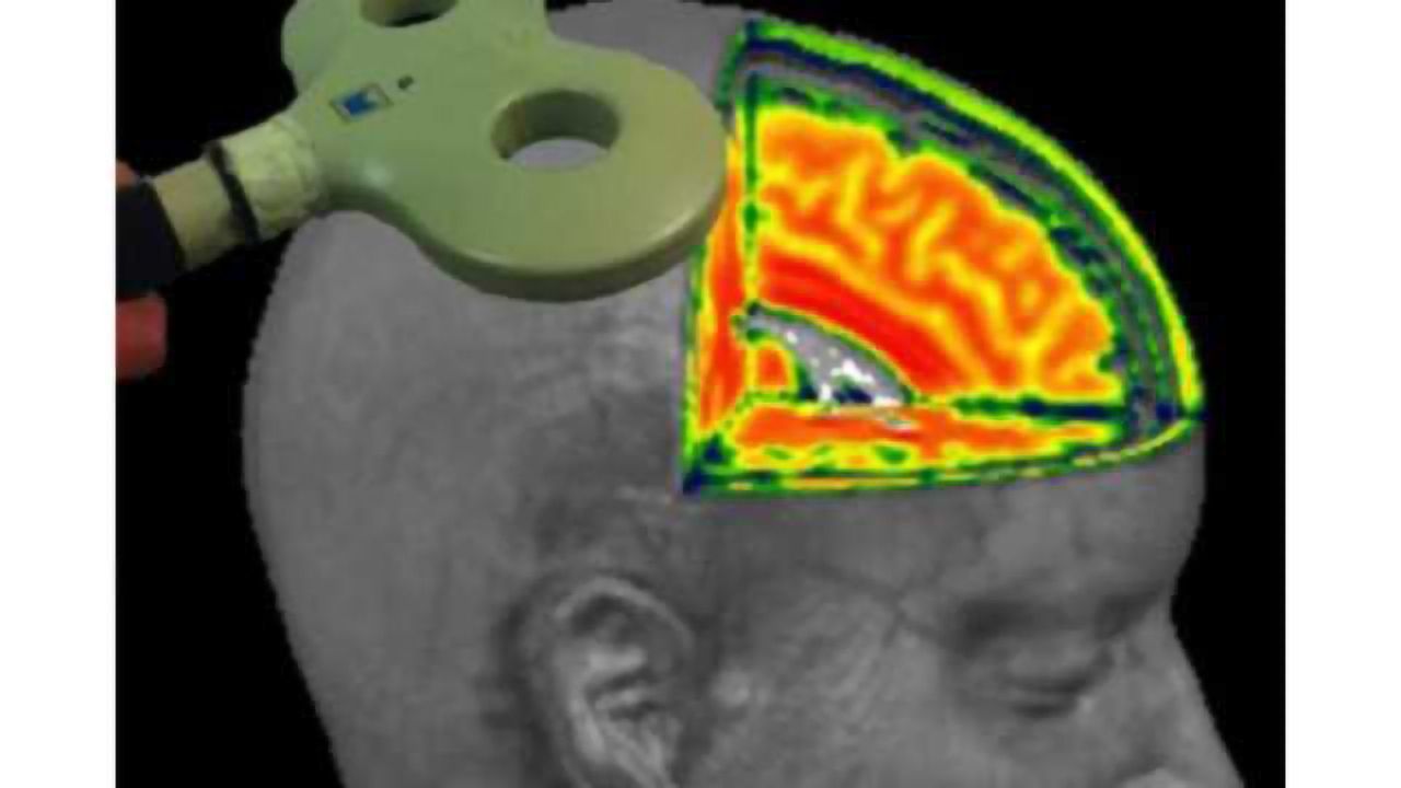 Visualising plastic changes to the brain | Technology Networks