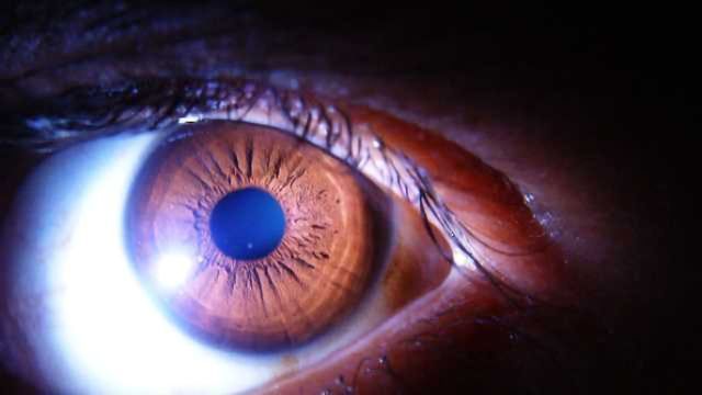 Research Reveals Likelihood and Onset of Multiple Sclerosis Diagnosis ...