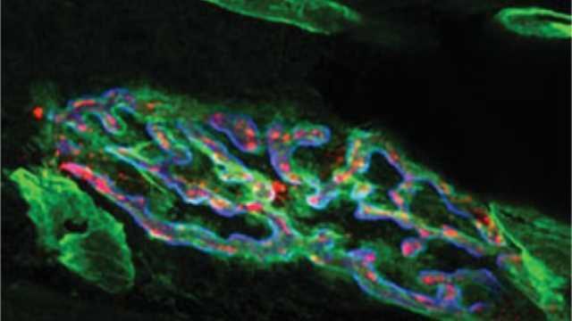 Secret of tetanus toxicity offers new way to treat motor neuron disease ...