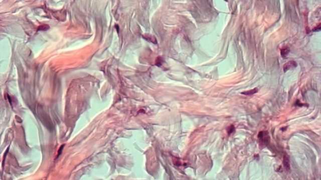 Skin Test May Shed New Light on Alzheimer’s and Parkinson’s Diseases ...