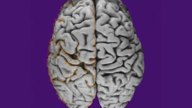 Mutations taking place only in the brain identified as the cause of ...