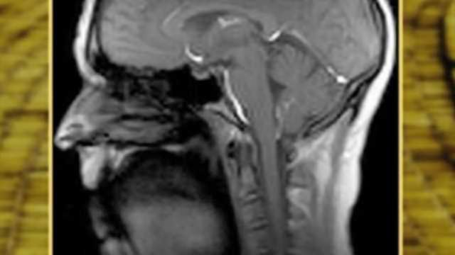 Neuroscience News | Page 1054 | Technology Networks