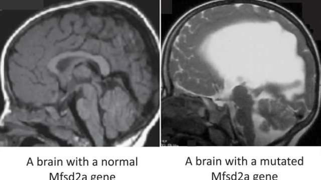 Special fats proven essential for brain growth | Technology Networks