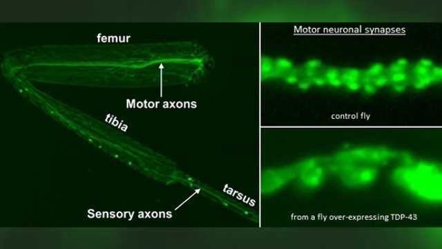 Novel fly model of motor neuron degeneration provides new avenues for ...