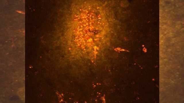 New Finding Will Help Target Multiple Sclerosis Immune Response 1047