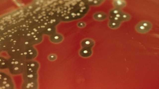 How recurrent Strep A infections affect the brain | Technology Networks