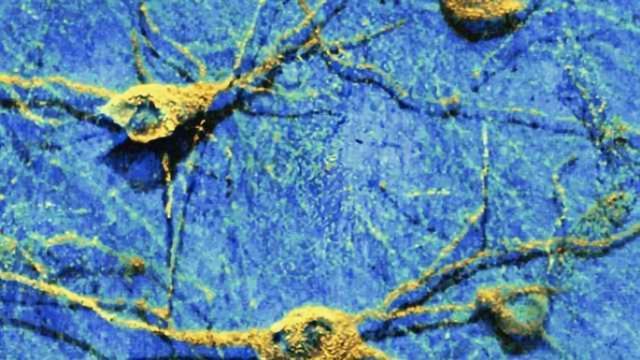 Graphene shown to safely interact with neurons in the brain ...