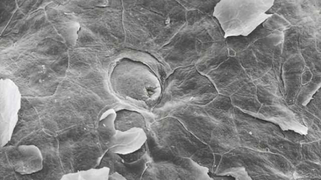 Brain scars in multiple sclerosis patients reveal possible cause of ...