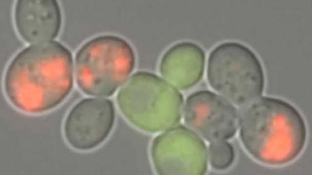 Shedding new light on protein aggregates and the diseases they cause ...