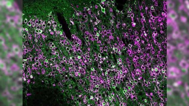Refining Optogenetic Methods To Map Synaptic Connections In The Brain Technology Networks