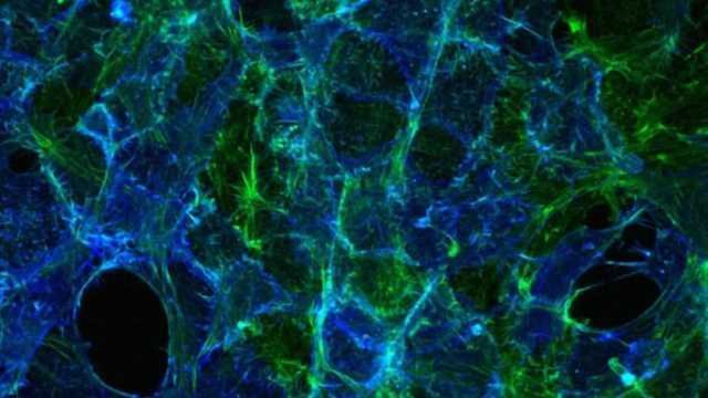 Imaging technique maps serotonin activity in living brains | Technology ...