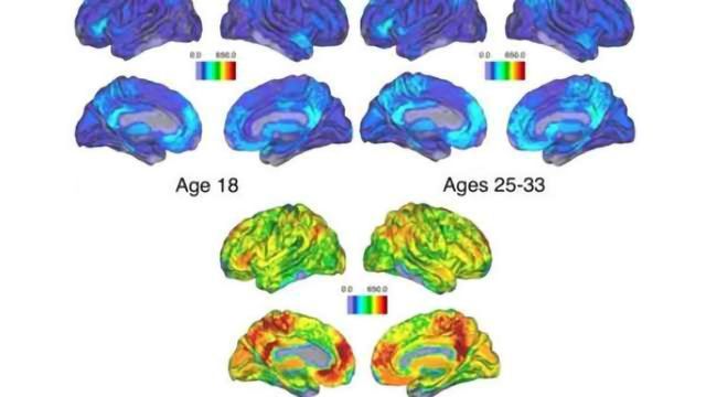 Memory-related brain activity loses cohesion as people age | Technology ... Memory-related brain activity loses cohesion as people age | Technology ...