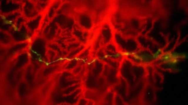 Scientists take step toward mapping how the brain stores memories ...