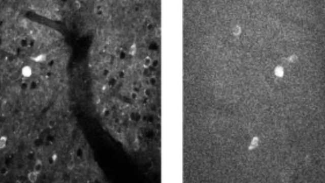 Non-Invasive Imaging of Mouse Brain Developed | Technology Networks