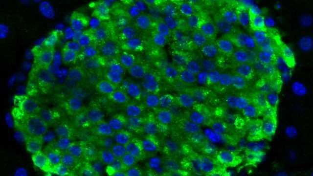 Pathways Regulating Beta Cell Growth Identified | Technology Networks