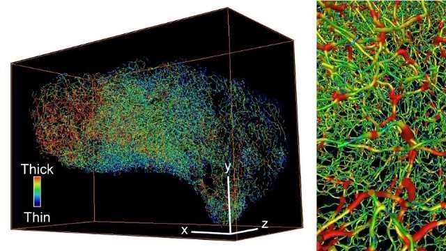 3D Microscopy Gives More Accurate Cancer Diagnosis | Technology Networks