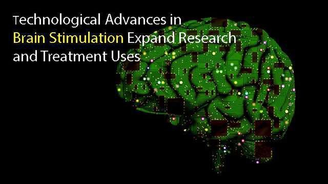 Advances in Brain Stimulation: Transforming How Neuroscientists Study ...