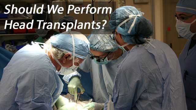 The Next Great Neuroscience Debate: Are head transplants ethical ...