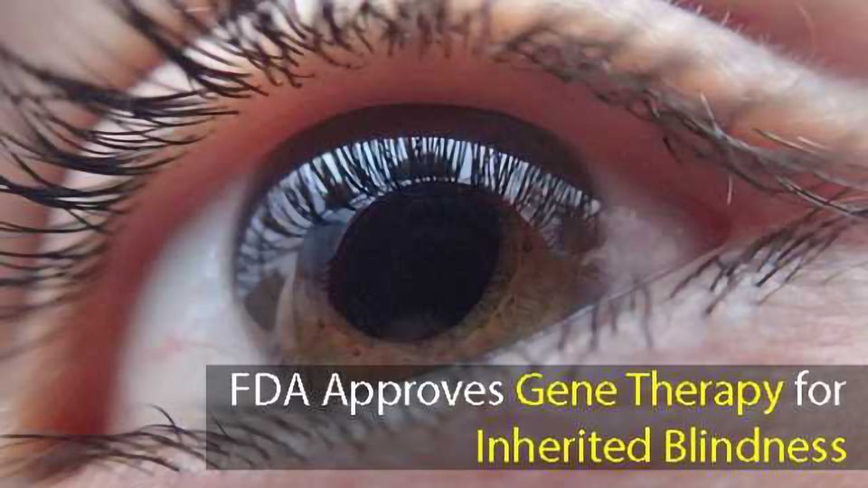 FDA Approves Gene Therapy for Inherited Blindness | Technology Networks