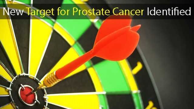 New Target for Prostate Cancer Identified | Technology Networks