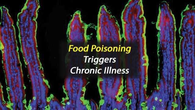 Repeated Mild Food Poisoning Triggers Chronic Disease | Technology Networks