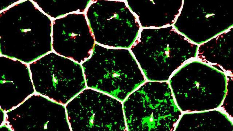 Stem Cell Therapy for Eye Disease Brought Closer to the Clinic ...