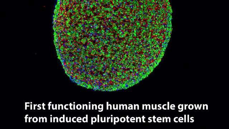 Engineers Grow Functioning Human Muscle from Skin Cells | Technology ...