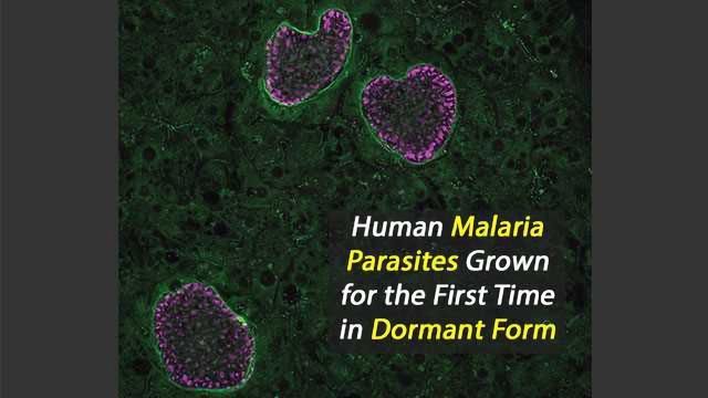 Human Malaria Parasites Grown for the First Time in Dormant Form ...