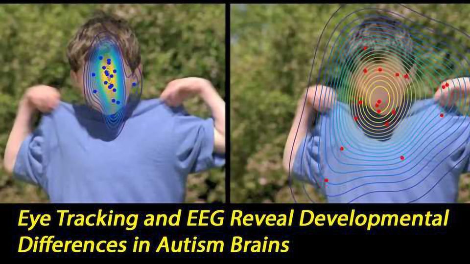 ‘Social Brain’ Networks are Altered at a Young Age in Autism ...