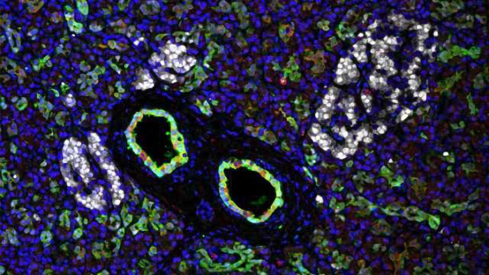 Unique Pancreatic Stem Cells Have Potential to Regenerate Beta Cells ...