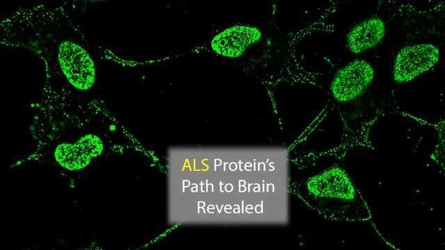 ALS Protein's Path into the Brain Documented | Technology Networks
