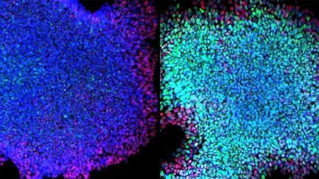 Missing Link Found Between Pathways Involved in Cell Development ...