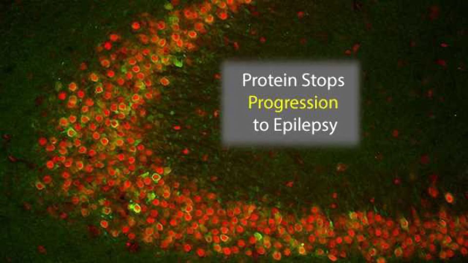 Brain Protein Helps Stop Progression to Epilepsy | Technology Networks