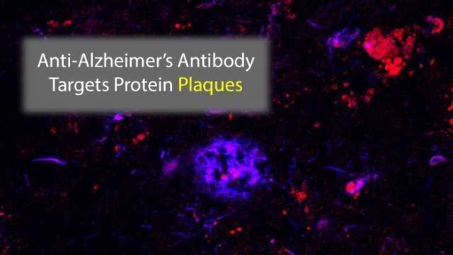 Anti-Alzheimer's Antibody Breaks Down Protein Plaques in Mice ...