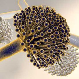 Introducing Fungiplex® Aspergillus real-time PCR | Technology Networks