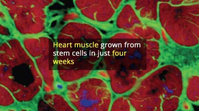 Adult-like Human Heart Muscle Grown from Patient-specific Stem Cells ...