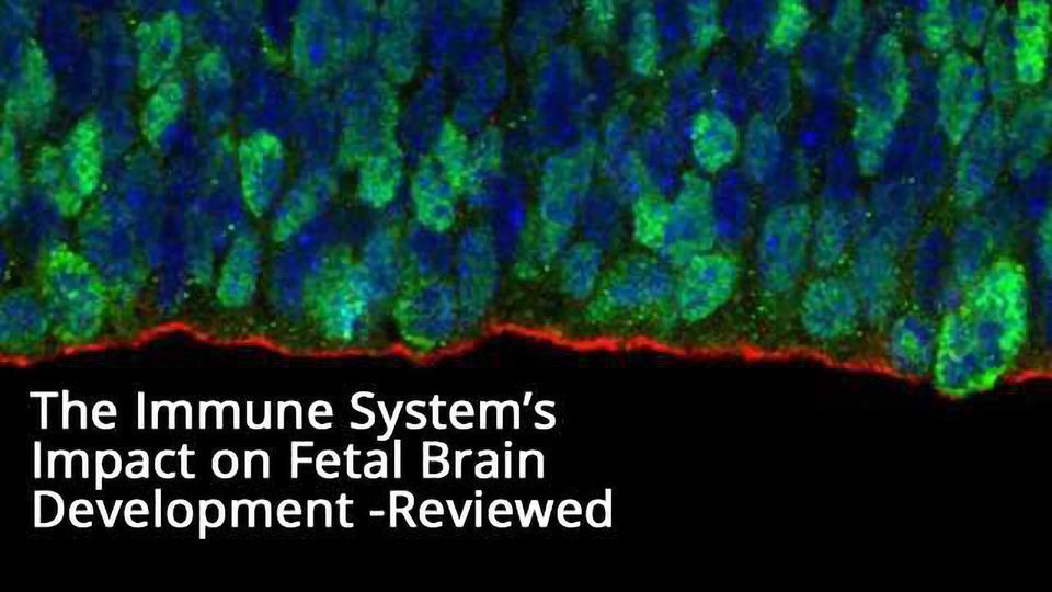 The Immune System's Influence on Brain Development Reviewed ...