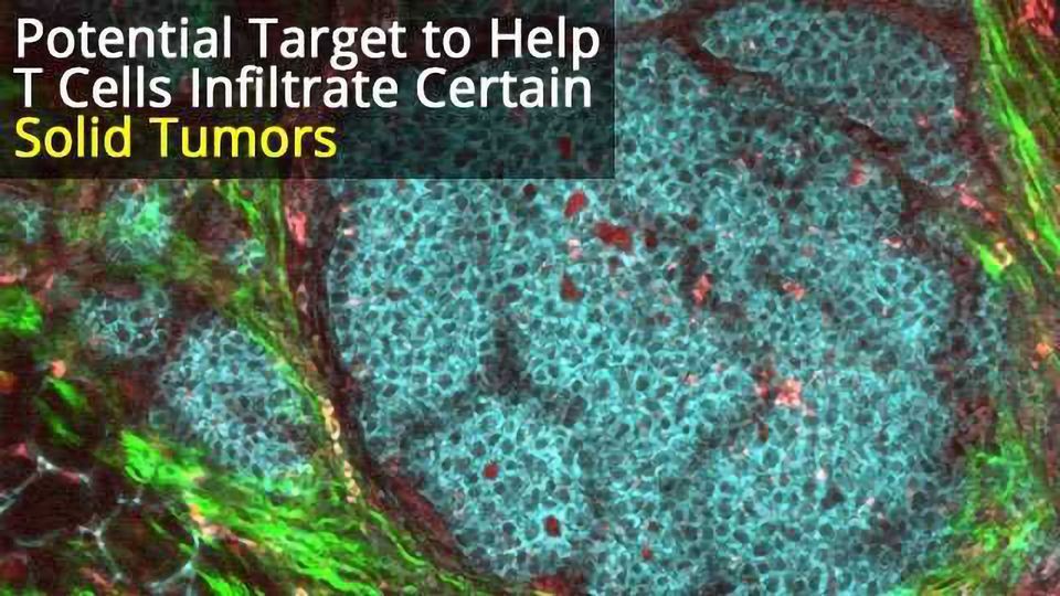 New Target for Immunotherapy for Solid Tumors? | Technology Networks