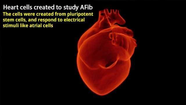 Atrial Cells Created from Stem Cells | Technology Networks