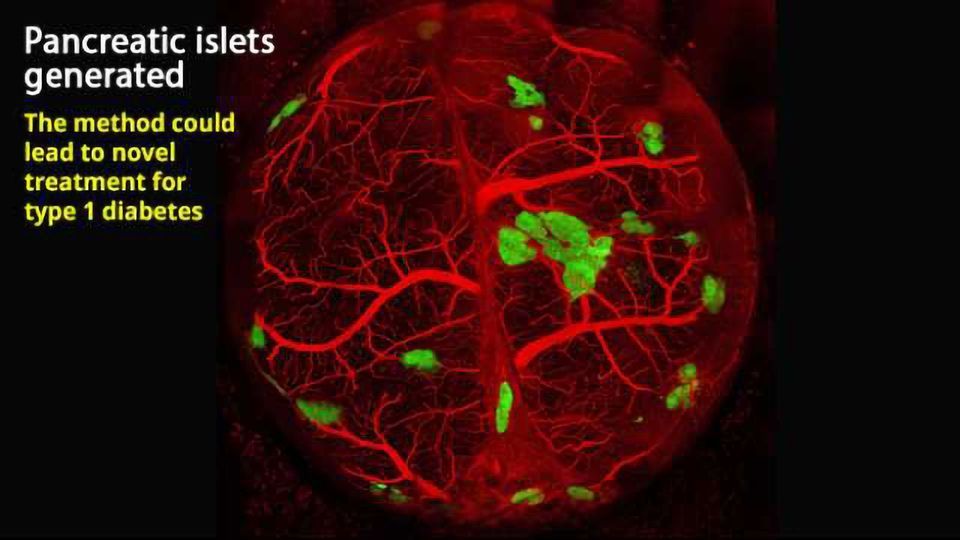 Tissue Engineered Human Pancreas Cells Successfully Treat Diabetic Mice ...