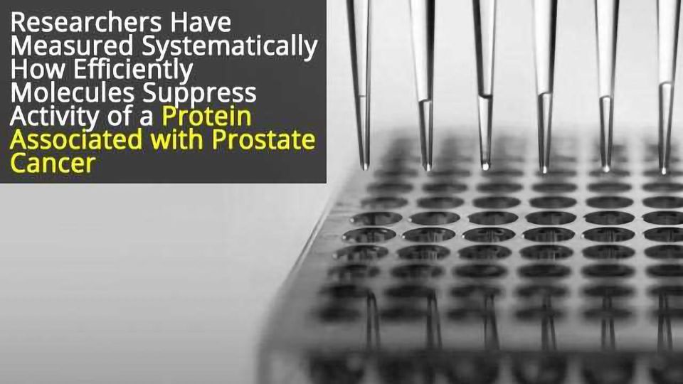 Prostate Cancer: Scientists Screen Molecules to Determine Most ...