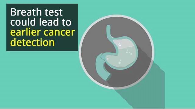 A Breath Test for Early Diagnosis of Oesophageal and Gastric Cancer ...