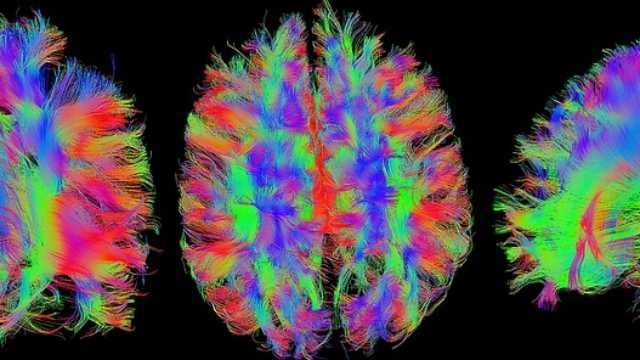 Understanding How Cues Drive Behavior | Technology Networks