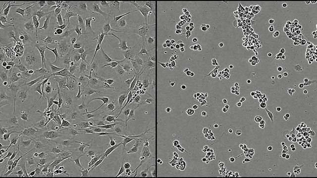 Making Malignant Brain Tumors Self-Destruct | Technology Networks