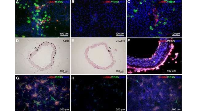 Beating Heart Muscle Cells Derived from Stem Cells | Technology Networks