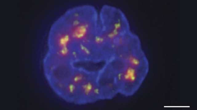 Building a 3D Map of the Genome | Technology Networks